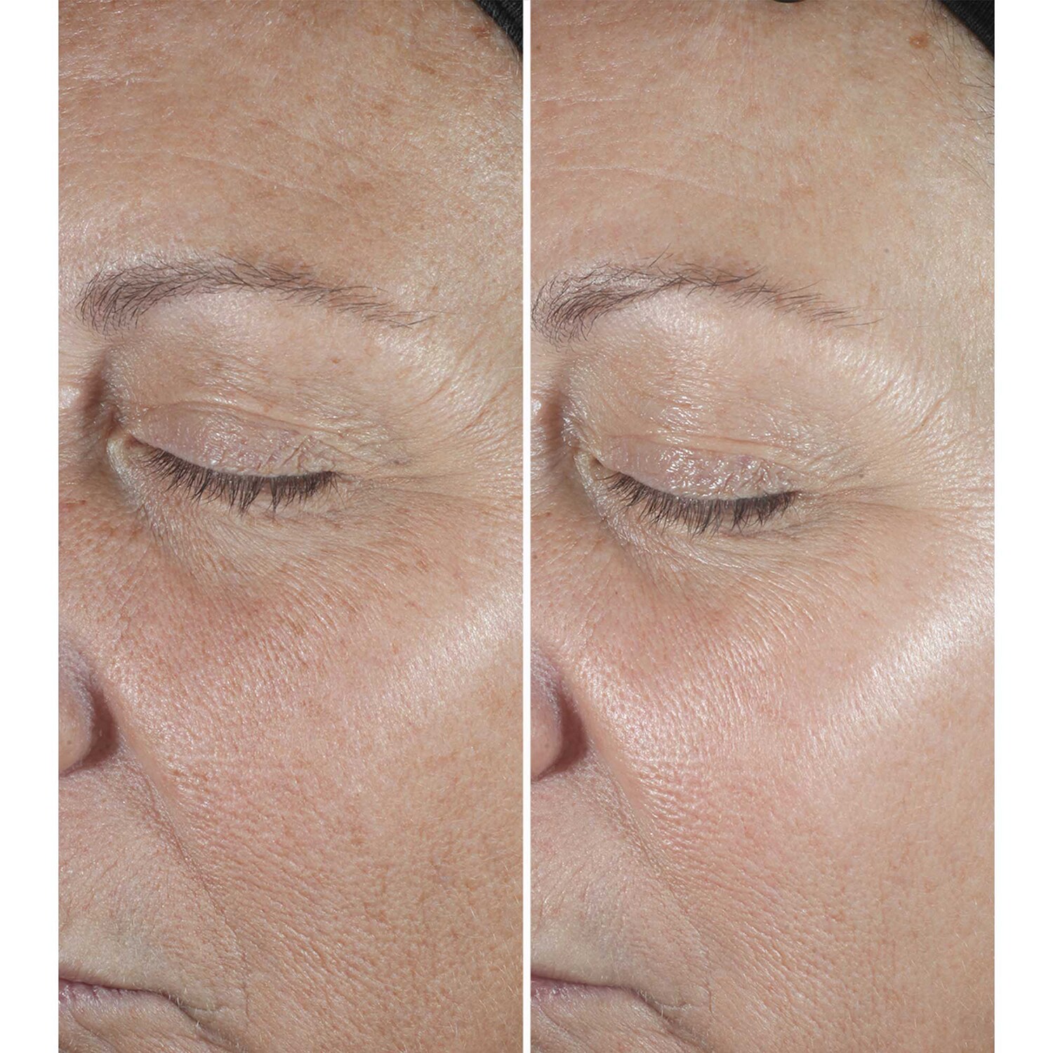 Clinique Smart - Serum przeciwzmarszczkowe korygujące i CLINIQUE ≡ SEPHORA